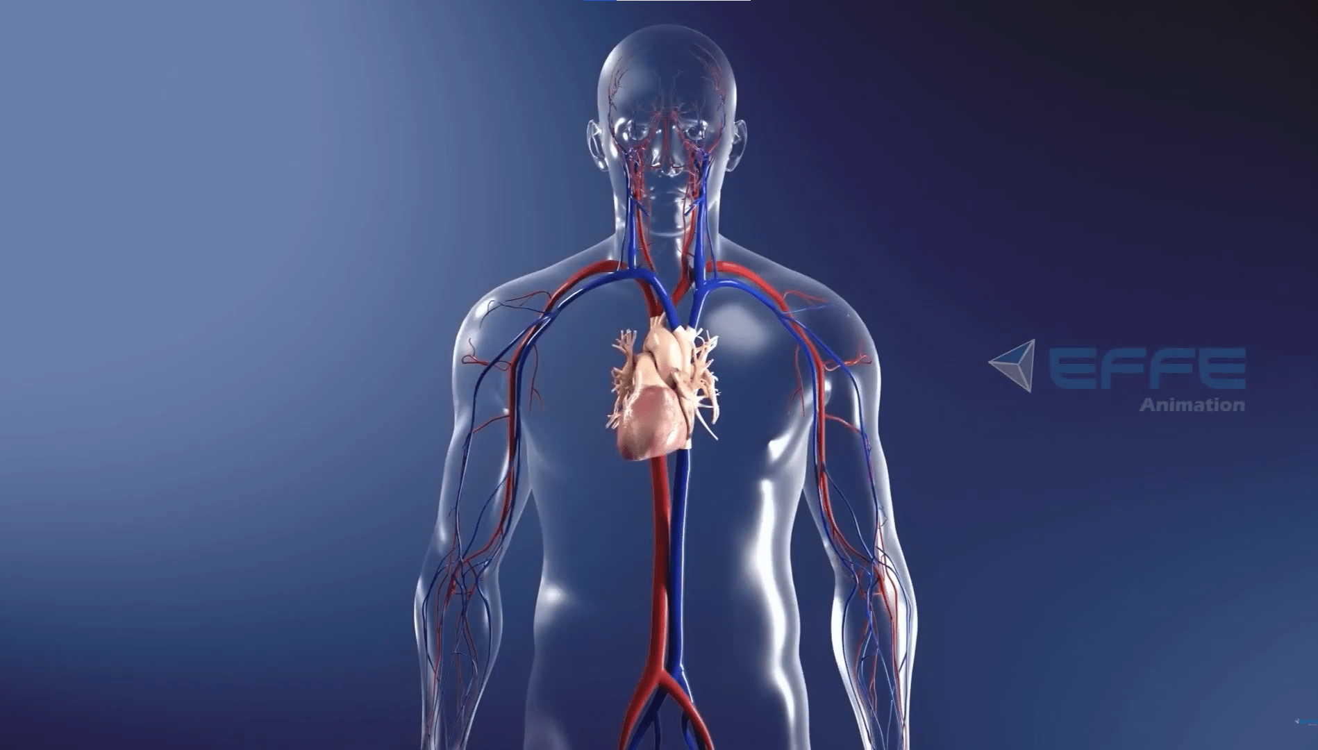 Heart Attack 3d Animation